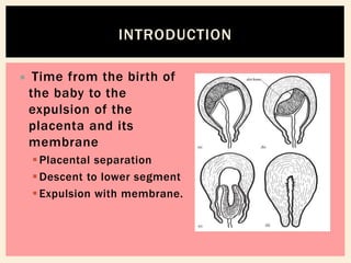 Mellss obg3 pph | PPTX | Pregnancy | Reproductive Health