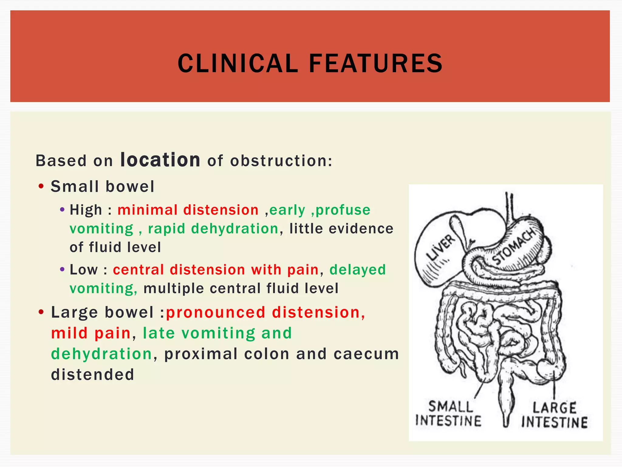 Mellss surgery y3 intestinal obstruction | PPTX