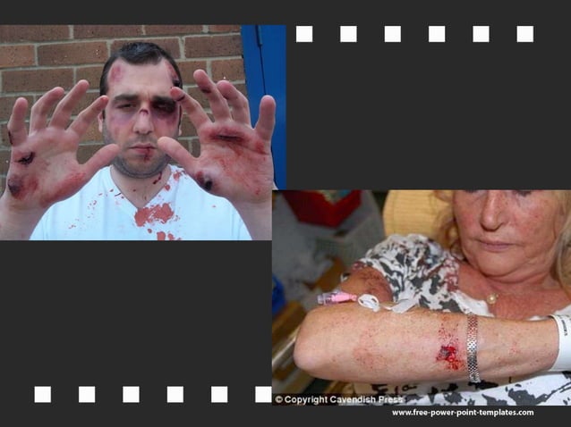 Mellss yr 4 forensic defence, hesitation, self inflicted and fabricated injuries | PPT