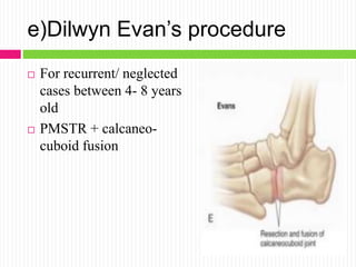 Mellss yr5 ortho treatment of congenital talipes equino varus (ctev) | PPT