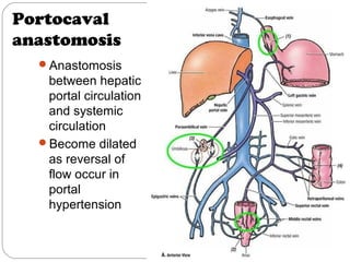 Mellss yr5 surgery portal hypertension intro | PPT