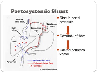 Mellss yr5 surgery portal hypertension intro | PPT
