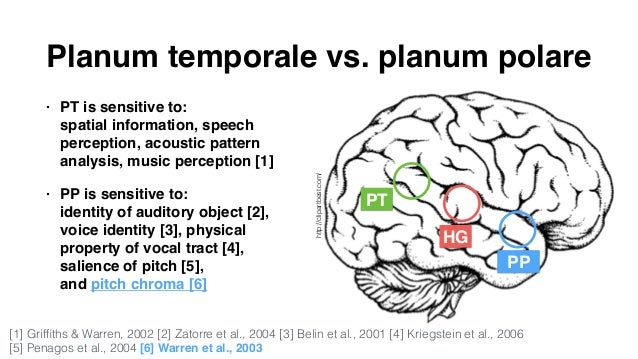 Intracortical myelination in musicians with absolute pitch