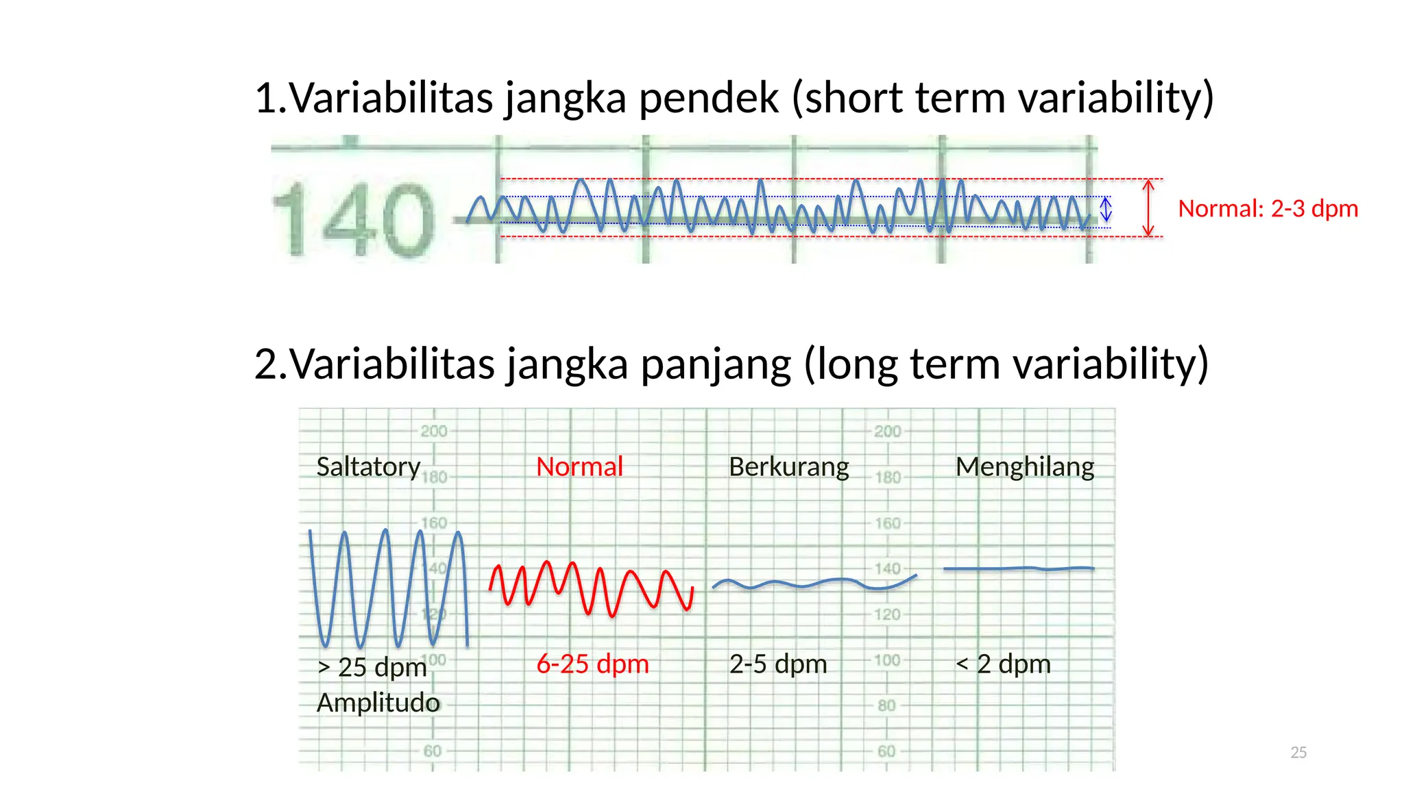 Membaca dan memahami Cardiotocografi normal | PPTX