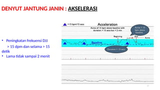 Membaca CTG normal untuk kesejahteraan janin - PIT IDI.pptx