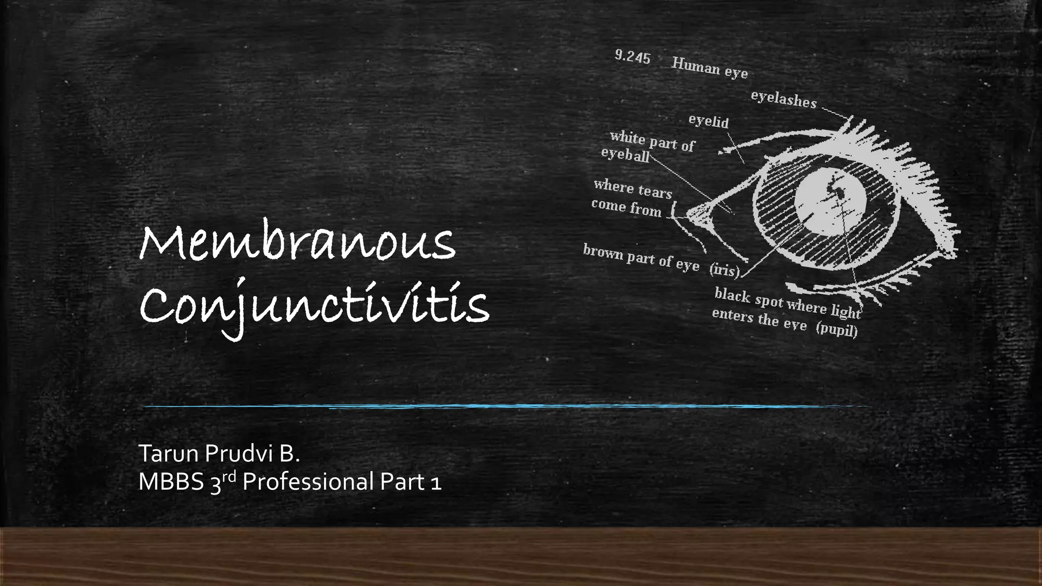 Membranous conjunctivitis | PPTX