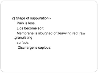 Membranous conjunctivits | PPTX