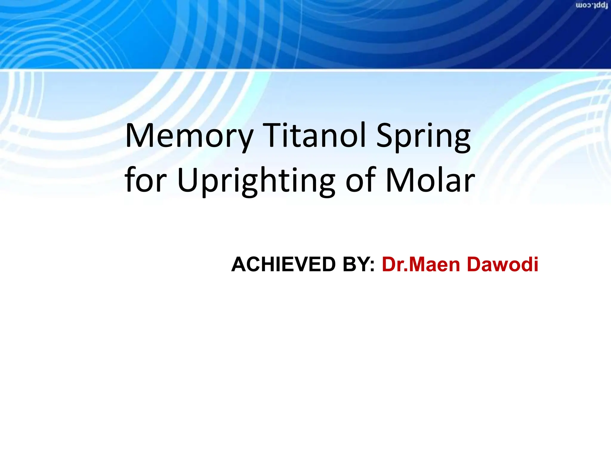 Memory Titanol Spring for Uprighting of Molar.pptx