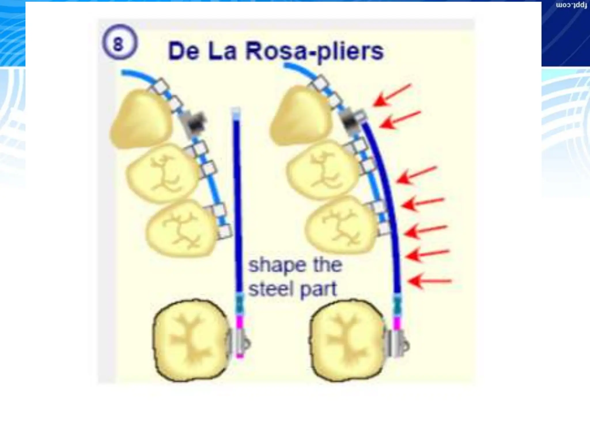 Memory Titanol Spring for Uprighting of Molar.pptx