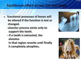 Memory Titanol Spring for Uprighting of Molar.pptx