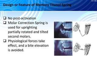 Memory Titanol Spring for Uprighting of Molar.pptx