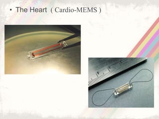 Microelectromechanical Devices And Applications of MEMs | PPTX