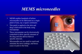 Mems in medical technology | PPT