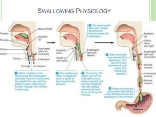 Mendelsohn Maneuver | PPTX