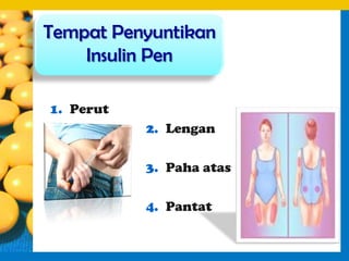 Mengenal Diabetes Mellitus | PPTX