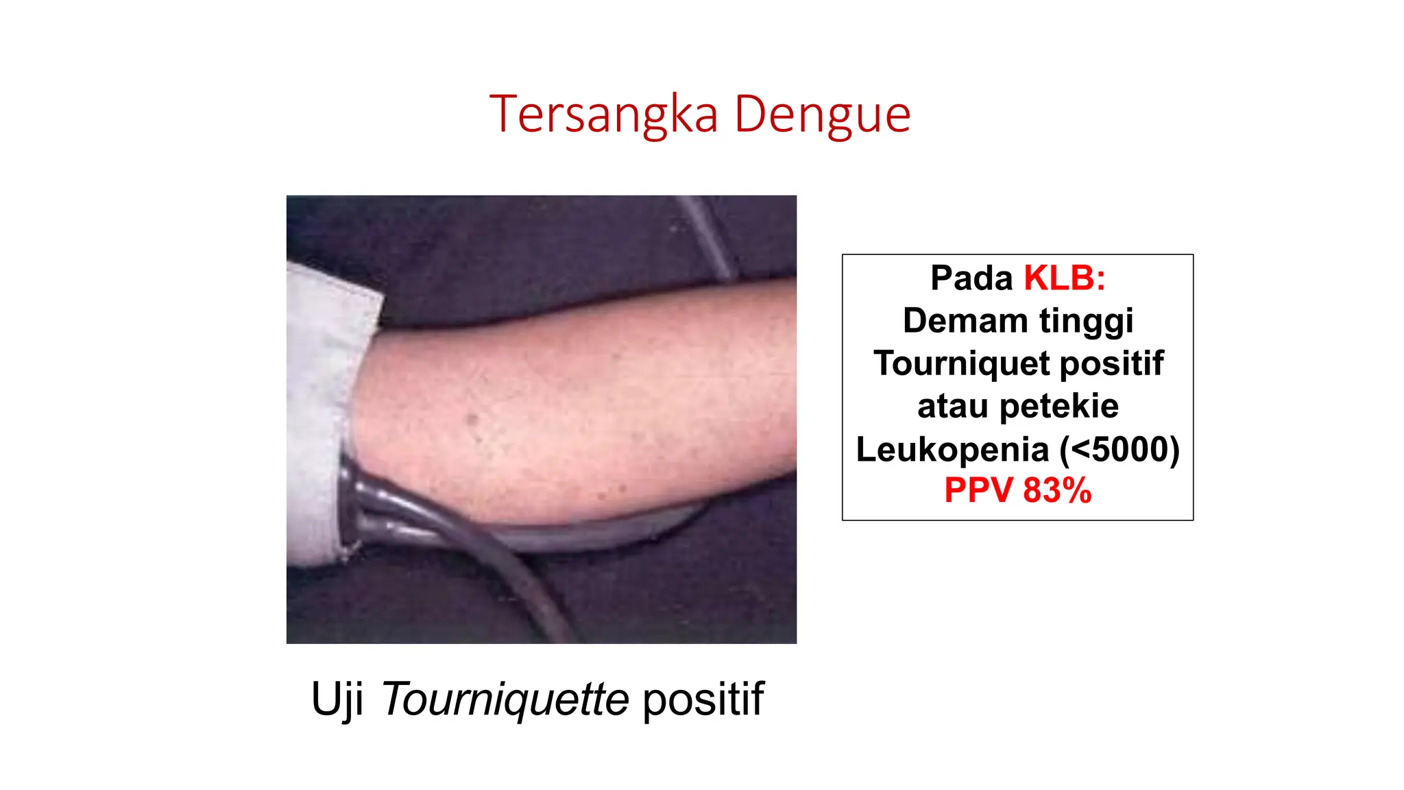 Mengenal_diagnosis_dan_tata_laksana_dengue_handout_Dr_Mulya_Rahma.pptx