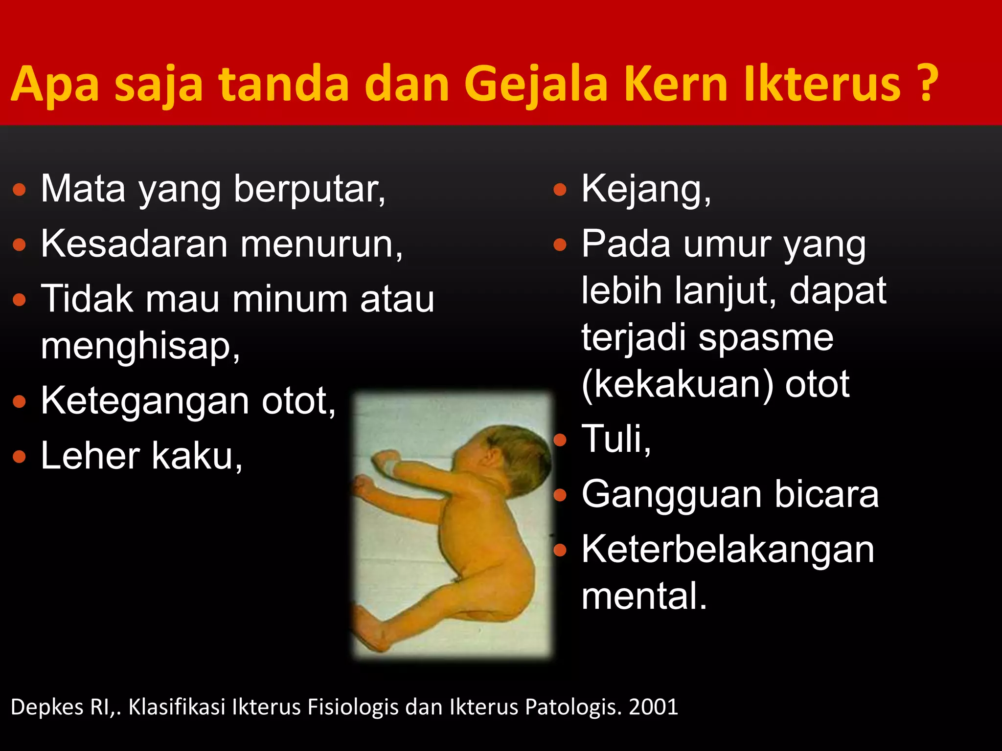 Mengenali bayi kuning dan penanganannya | PPTX