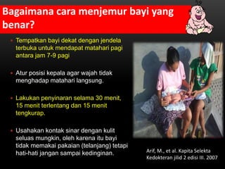 Mengenali bayi kuning dan penanganannya | PPTX