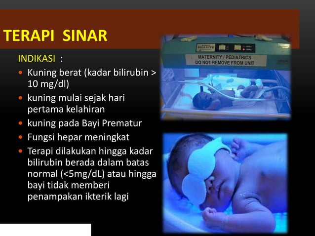 Mengenali bayi kuning dan penanganannya | PPTX