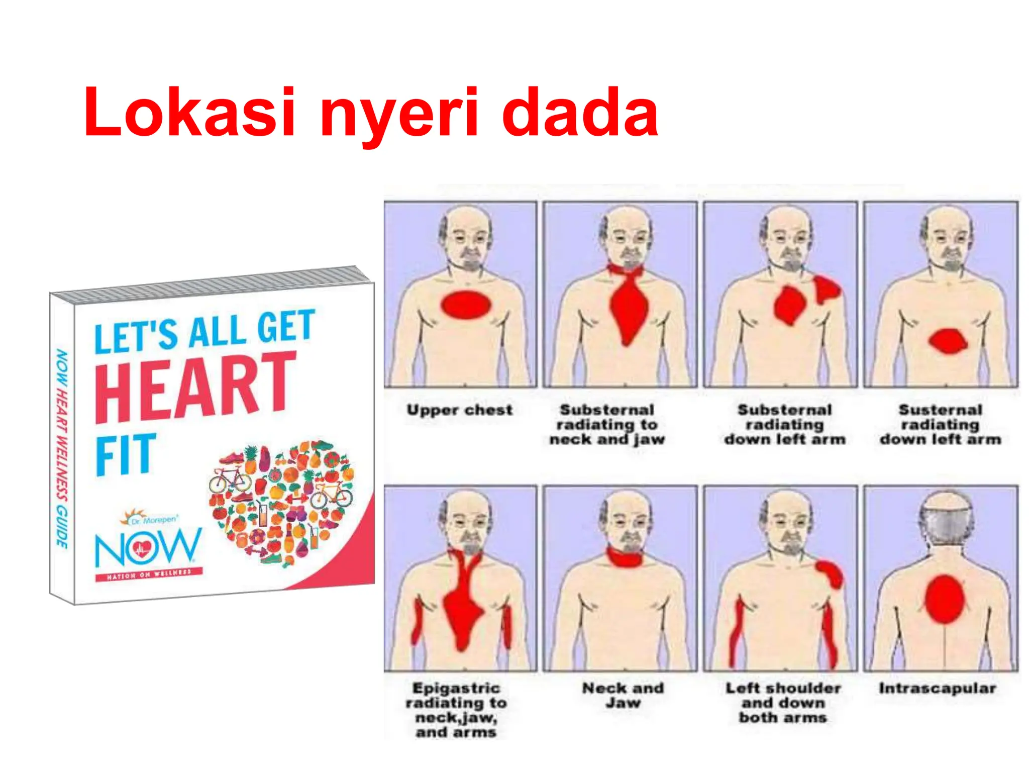 Mengenali_tanda_dan_gejala_serangan_dini_penyakit_jantung_dr_Bambang.pptx