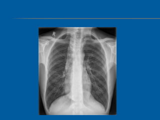 MENGENAL NAKES PROFESI RADIOGRAFER MG.ppt