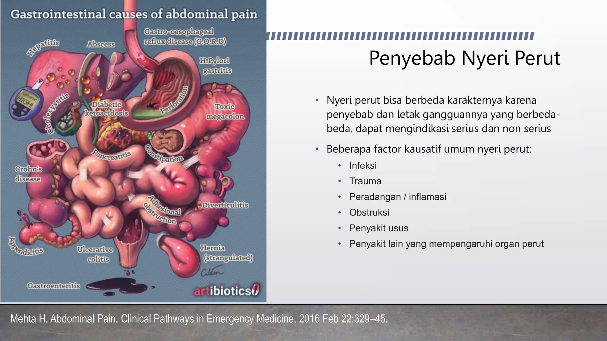 Mengenal Nyeri Perut tentang jenis dan karakteristik.pptx