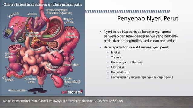 Mengenal Nyeri Perut tentang jenis dan karakteristik.pptx
