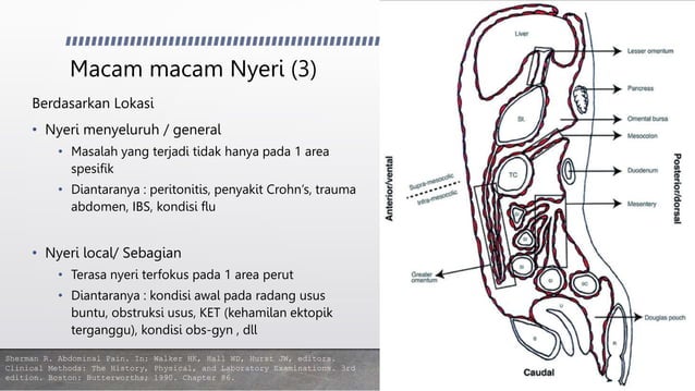 Mengenal Nyeri Perut tentang jenis dan karakteristik.pptx