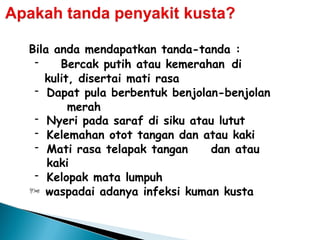 Mengenal Penyakit Kustapengertian dan gejala.pptx
