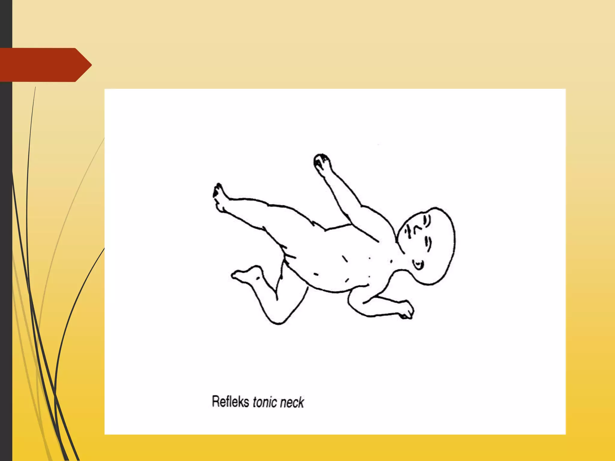 Mengenal refleks-refleks fisiologis primitif pada bayi baru 2019 (1).pptx