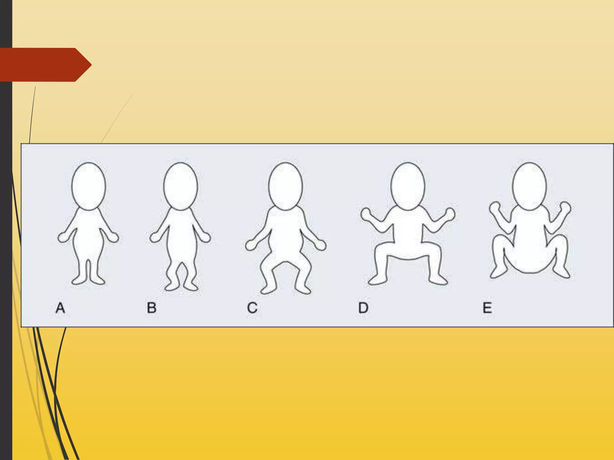 Mengenal refleks-refleks fisiologis primitif pada bayi baru 2019 (1).pptx