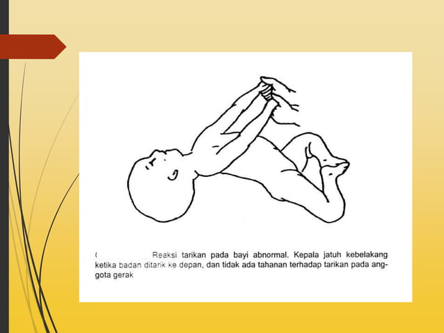 Mengenal refleks-refleks fisiologis primitif pada bayi baru 2019 (1).pptx