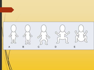 Mengenal refleks-refleks fisiologis primitif pada bayi baru 2019 (1).pptx