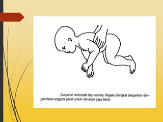 Mengenal refleks-refleks fisiologis primitif pada bayi baru 2019 (1).pptx