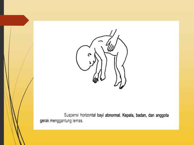 Mengenal refleks-refleks fisiologis primitif pada bayi baru 2019 (1).pptx