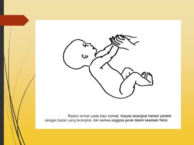 Mengenal refleks-refleks fisiologis primitif pada bayi baru 2019 (1).pptx