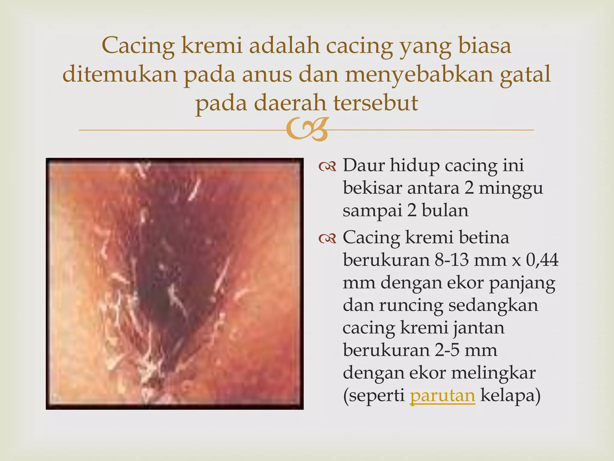 Mengenal siklus hidup cacing kremi (Enterobius vermicularis) | PPTX