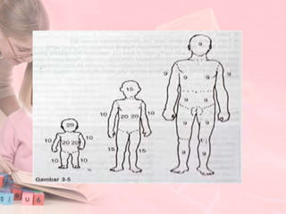 Menghitung luas luka bakar | PPTX