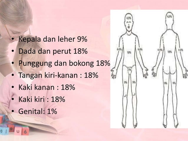 Menghitung luas luka bakar