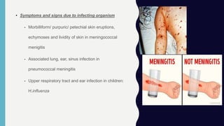 Mengitis | PPT