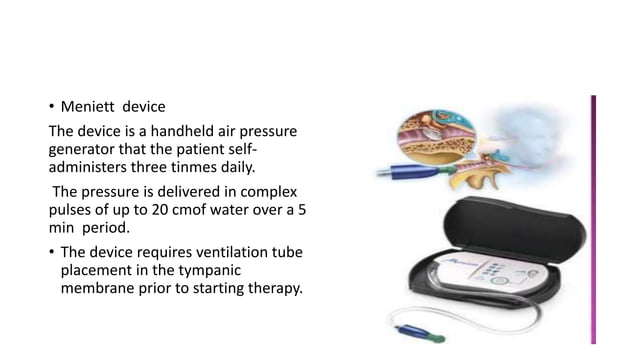 MENIERE.diesease pathophygiology sign and symaptom | PPT