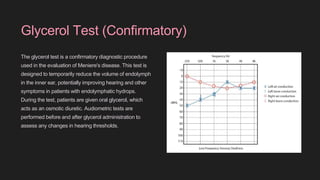 COMPREHENSIVE ANALYSIS OF Menieres-Disease.pptx