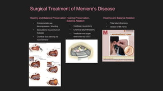 COMPREHENSIVE ANALYSIS OF Menieres-Disease.pptx
