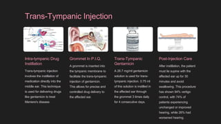 COMPREHENSIVE ANALYSIS OF Menieres-Disease.pptx