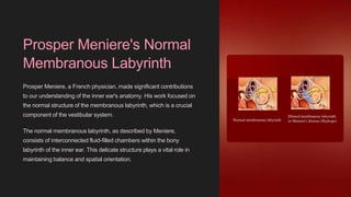 COMPREHENSIVE ANALYSIS OF Menieres-Disease.pptx