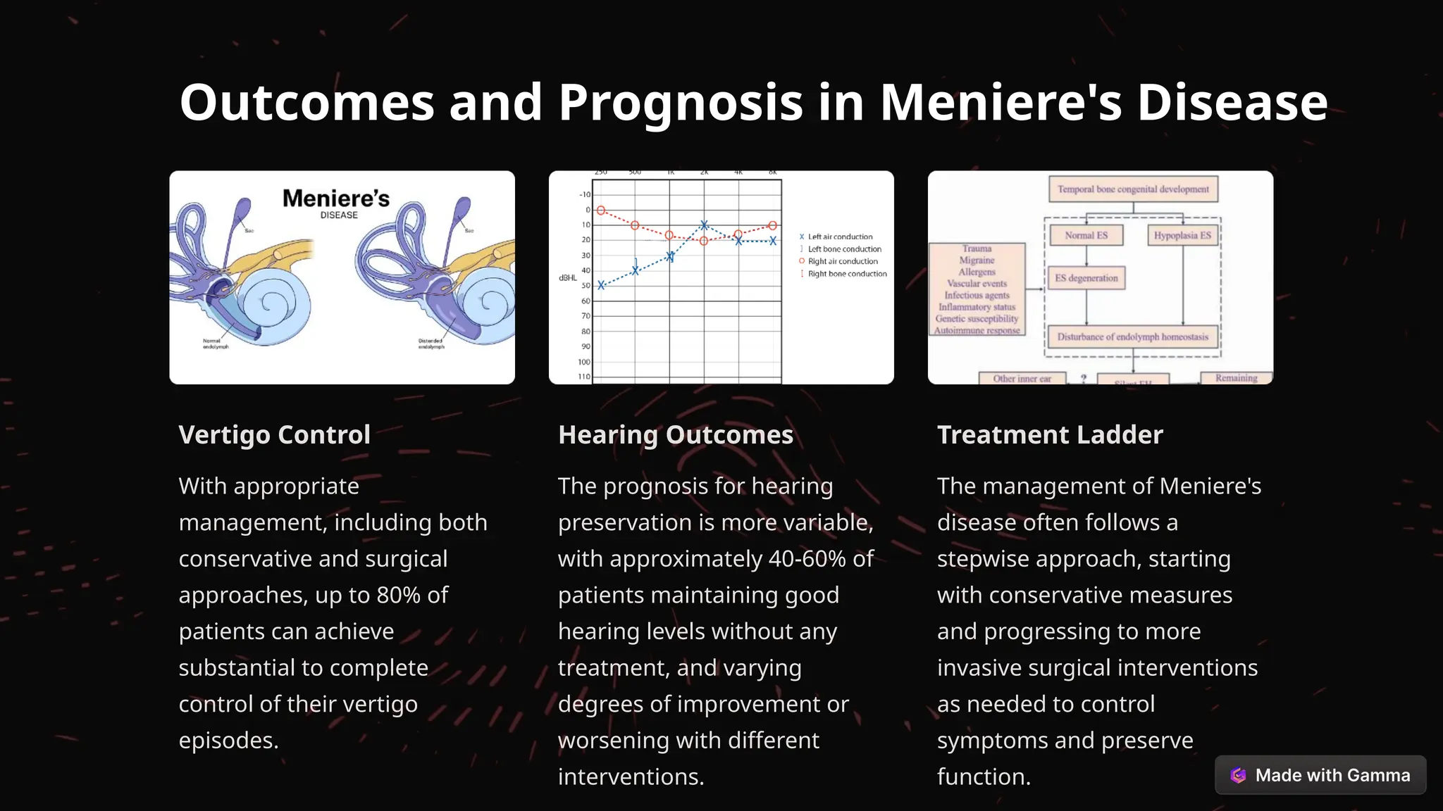 Menieres-Disease-A-Comprehensive-Overview.pptx
