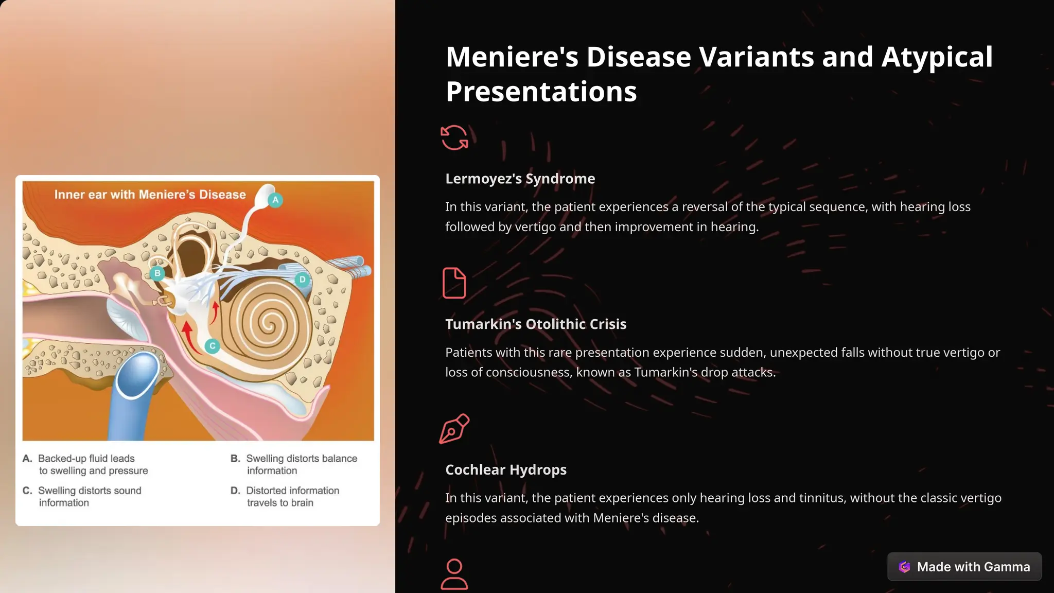 Menieres-Disease-A-Comprehensive-Overview.pptx