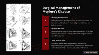Menieres-Disease-A-Comprehensive-Overview.pptx