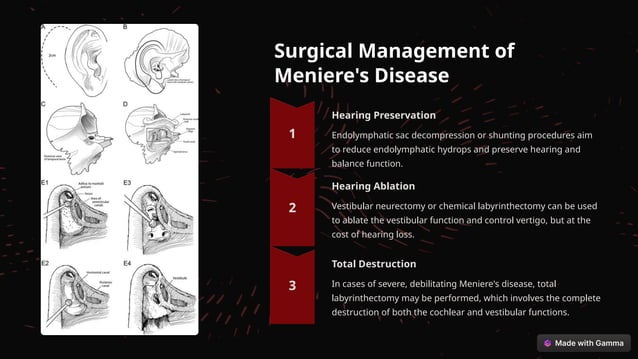 Menieres-Disease-A-Comprehensive-Overview.pptx | Ear, Nose and Throat ...