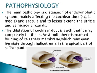 Meniere's disease | PPT